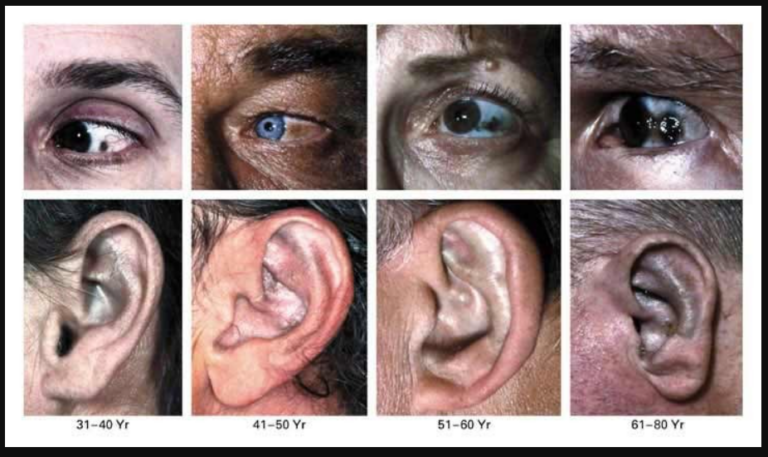 9 Rarest Genetic Disorders In The World - Rarest.org